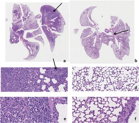 Histological Examination Of Lungs Of Mice After Intranasal Infection Download Scientific