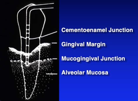 Lecture 5 Mucogingival Defects Furcation Involvement And