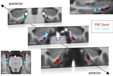 Figures And Data In Functional Subregions Of The Human Entorhinal