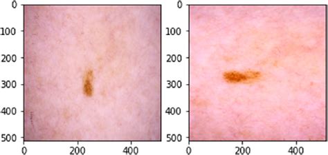 Comparison Of The Application Of Data Augmentation On An Example Image Download Scientific