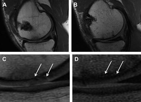 Application Of Advanced Magnetic Resonance Imaging Techniques In