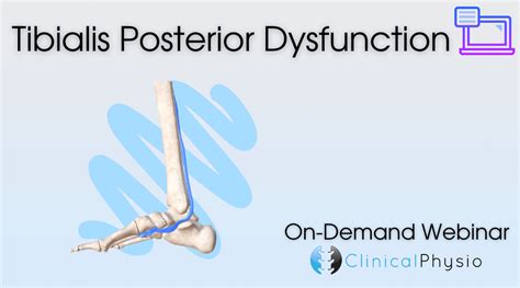 Tibialis Posterior Dysfunction Clinical Physio