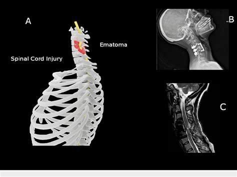 Figure 1 From Semi Immersive Virtual Reality Exercise Therapy For Upper Limb Rehabilitation In