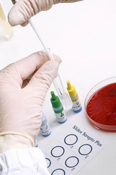 Streptococcus Grouping Test C013 8758 Our Beautiful Wall Art And