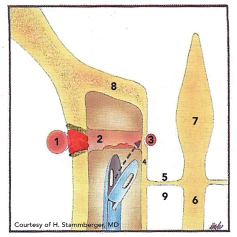 Anterior Ethmoidal Foramen Semantic Scholar