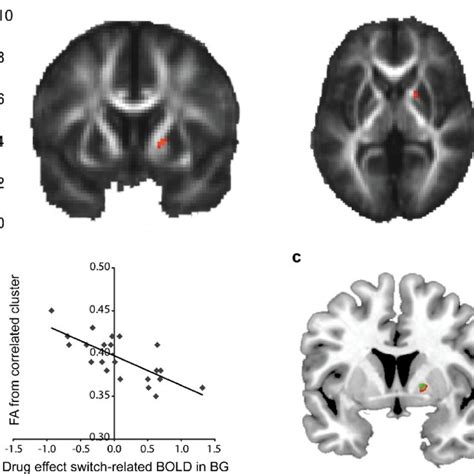 A Whole Brain Statistical Parametric Map Unmasked Of Association Download Scientific Diagram