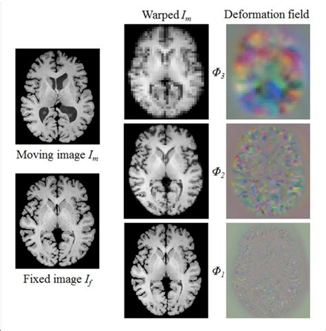 One Example To Illustrate The Multi Scale Deformable Registration Download Scientific Diagram