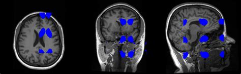 Randaffined Does Not Work As Expected · Issue 3316 · Project Monai Monai · Github