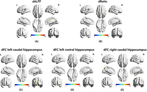 Comparison Of Dalff Variability Dreho Variability And Dfc Variability