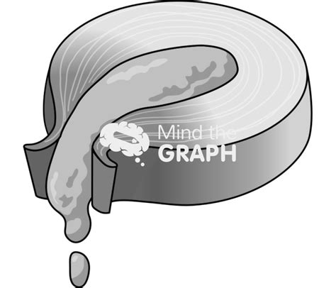 Free Disc Herniation Sequestration Icons Symbols Pictures And Images