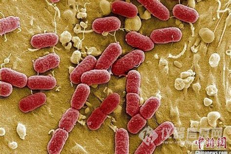 大肠杆菌油镜图片手绘观察第3页大山谷图库