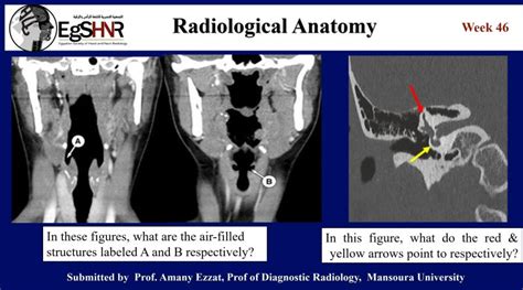 What Are The Findings Of The Case Of The Week Radiology