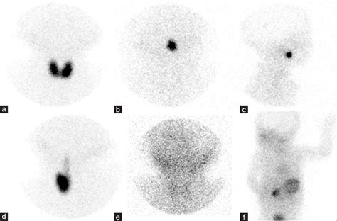 Journal Of Clinical Imaging Science Browse Articles