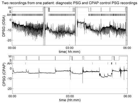 Two Examples One For Each Group Of The Mandible Movement Signal In