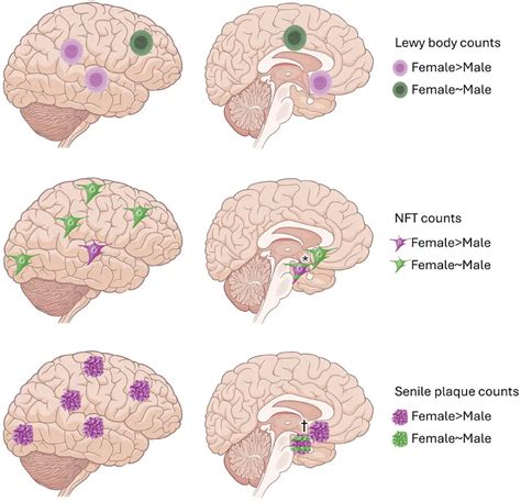 Sex Differences For Regional Pathology In People With A High Likelihood Of Lewy Body Dementia