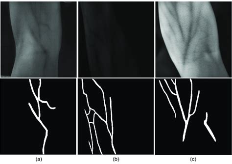 Some Samples Of The Dataset A Arm Images Under A Natural Light