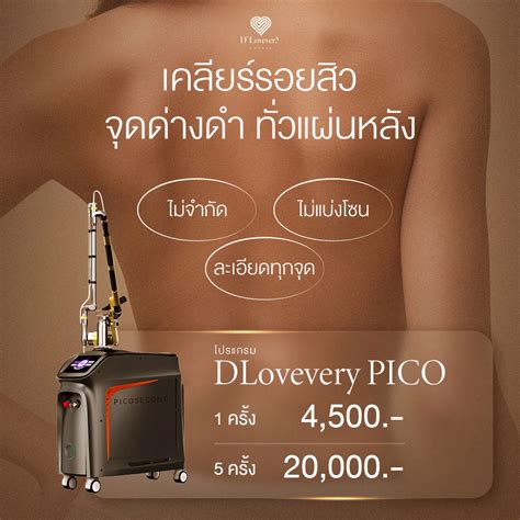 รอยสิวที่หลังกวนใจ โปรสุดคุ้ม Pico Laser เริ่มต้น 4 500 5 ครั้ง