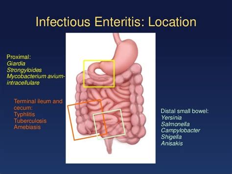 Enteritis And Colitis