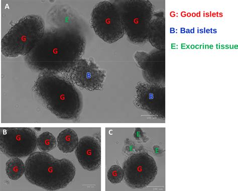 Video A Simple High Efficiency Protocol For Pancreatic Islet Isolation From Mice