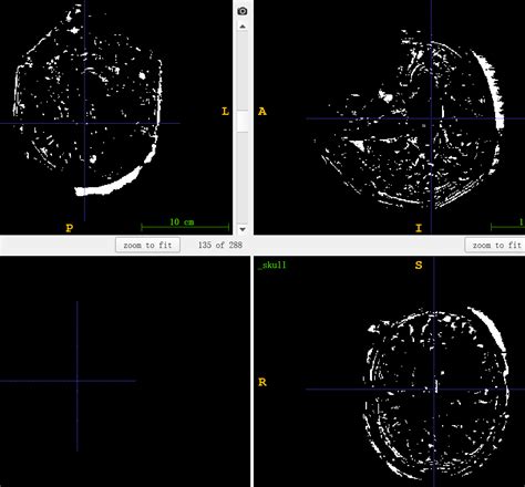 Acenet Issues · Issue 1 · Ymli39acenet For Neuroanatomy Segmentation