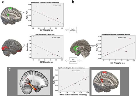 Pairs Of Regions Showing Significant Functional Connectivity Download Scientific Diagram