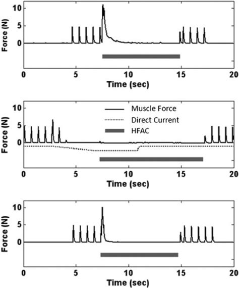sequence of three consecutive trials demonstrating block of the onset