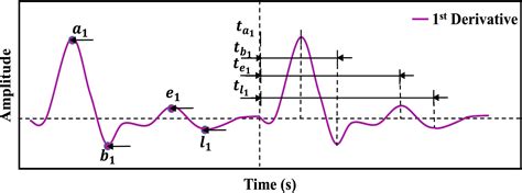 A continuous cuffless blood pressure measurement from optimal PPG ...