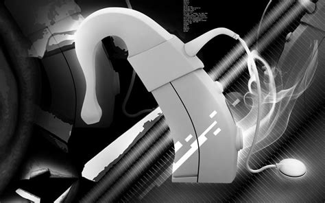 Bone Conduction Implant Shining Ears Foundation