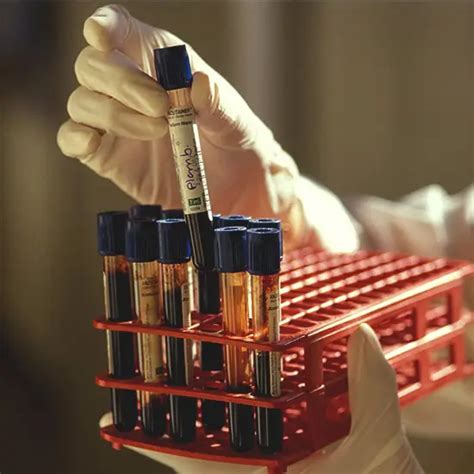 Serum Triglycerides Tg Test Price In Delhi Cost Near Me India