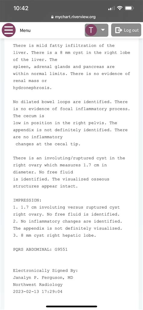 Ct Scan Results Rovariancysts