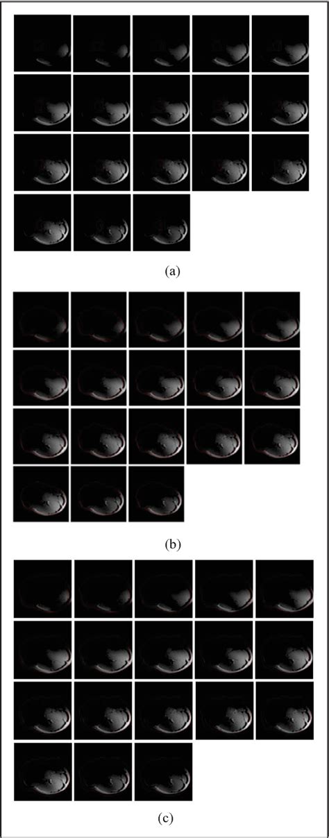Figure From Multilayer Image Segmentation Based On Gaussian Weighted Euclidean Distance And
