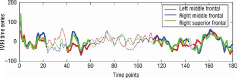 Example Of A Time Series Pattern That Shows Three Different Brain Download Scientific Diagram