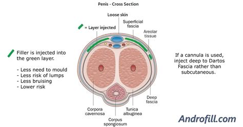 Androfill Penis Fillers Androfill Canada