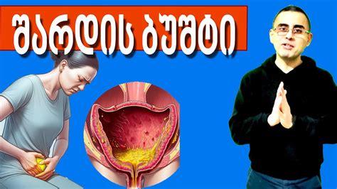 ქრონიკული ცისტიტი შარდის ბუშტის ანთება მკურნალობა Youtube
