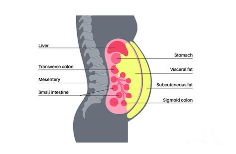 Visceral Fat Diagram 9 By Pikovit Science Photo Library