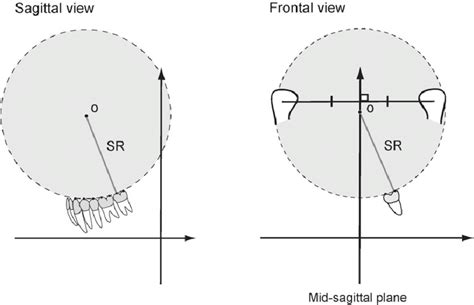 Schematic Representation For Determination Of Occlusal Curvature Download Scientific Diagram