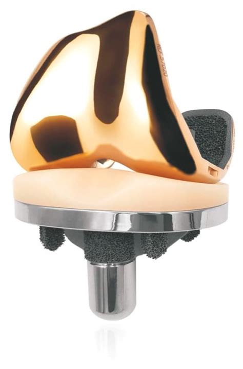 Cementless Total Knee Arthroplasty Encyclopedia Mdpi