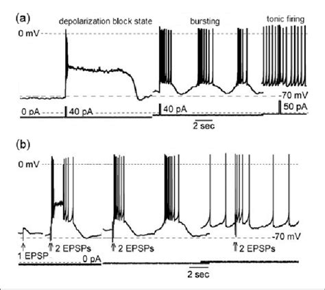 Different Patterns Of Subthalamic Nucleus Stn Neuronal Activity Stn