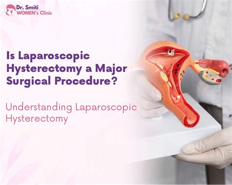 Is Laparoscopic Hysterectomy A Major Surgical Procedure