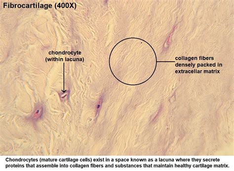 Fibrocartilage 400x Hyaline Cartilage