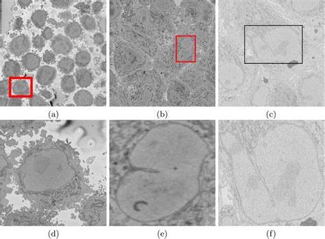 Chlamydia Trachomatis Microscopy
