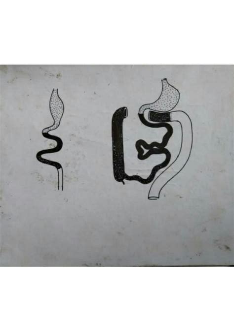 Solution Anatomy Embryology Charts Studypool