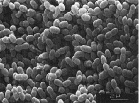 5 Morphologie En Microscopie électronique De Lactococcus Lactis Download Scientific Diagram