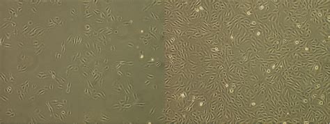 How Fit Are You In Cell Confluency Estimations