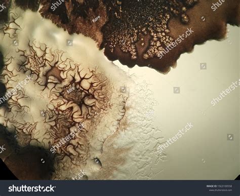 9 248 Bacterial Colonies Images Stock Photos Vectors Shutterstock