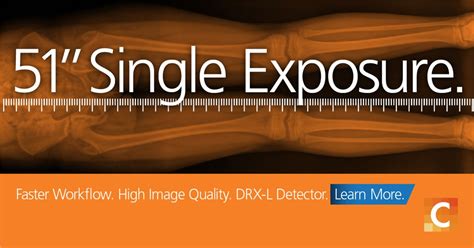 Orthopedics This Week On Linkedin Single Exposure Lli From Carestream Long Length Imaging Can