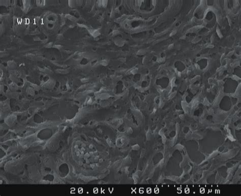 Scanning Electron Microscopy Observations And Elemental Composition