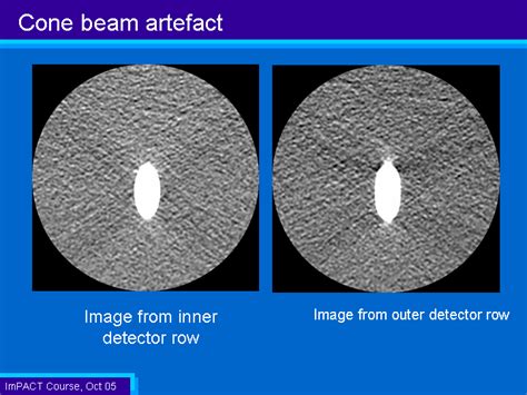 Cone Beam Artefact