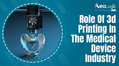 Role Of 3d Printing In The Medical Device Industry Aeologic Blog