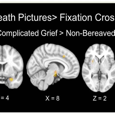 Brain Regions Showing Significant Group X Image Type Interaction The